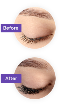 Cilash - New solution for hair loss